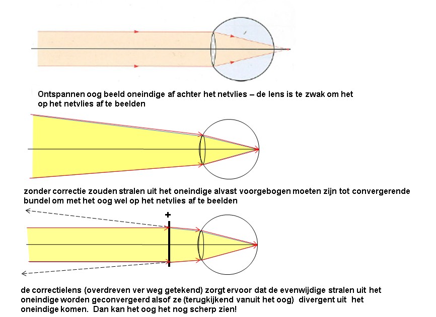 Natuurkunde.nl - Oogafwijking
